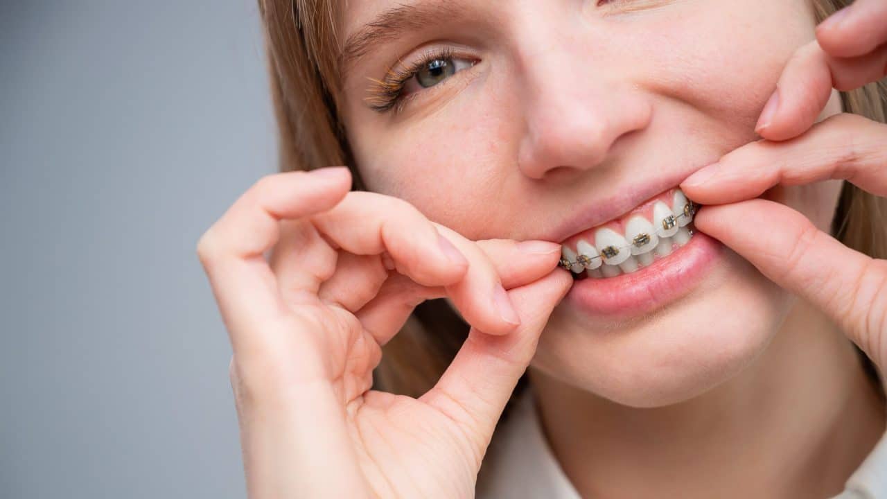 Invisalign vs. Traditional Braces: A Comparative Analysis - Mayfaire ...